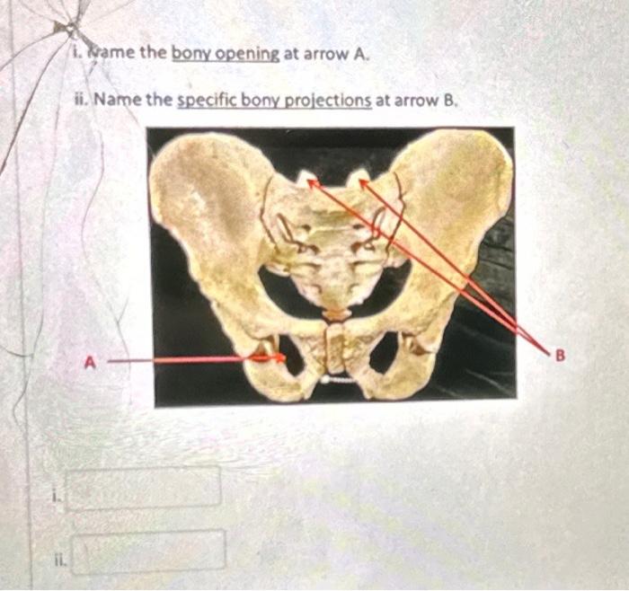 Solved 1. Name the specific bony structure at arrow A and | Chegg.com