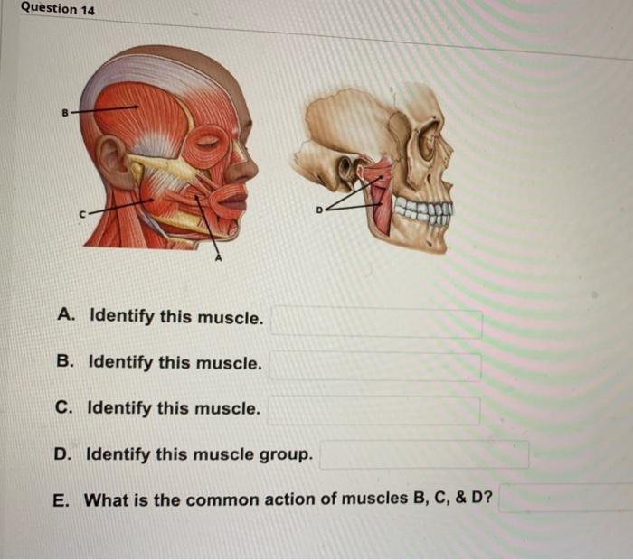 Solved Question 14 A. Identify this muscle. B. Identify this | Chegg.com