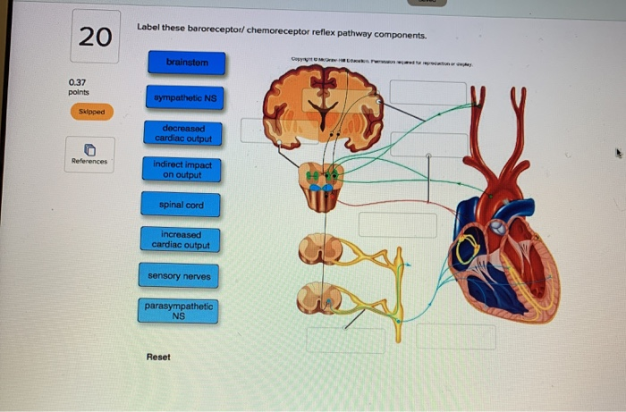 Solved Label these baroreceptor chemoreceptor reflex pathway | Chegg.com