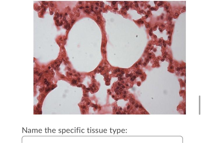 Solved + 1. General tissue type: EPITHELIAL Specific tissue | Chegg.com