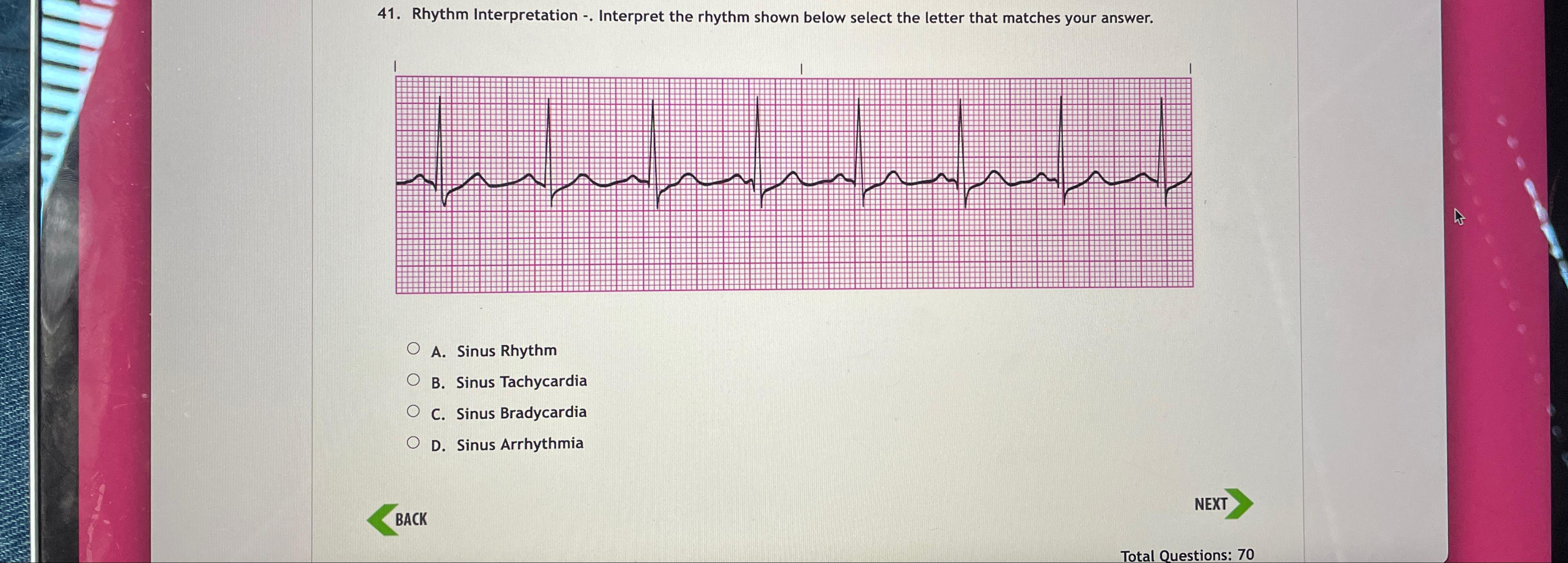 Solved Rhythm Interpretation -. ﻿Interpret the rhythm shown | Chegg.com