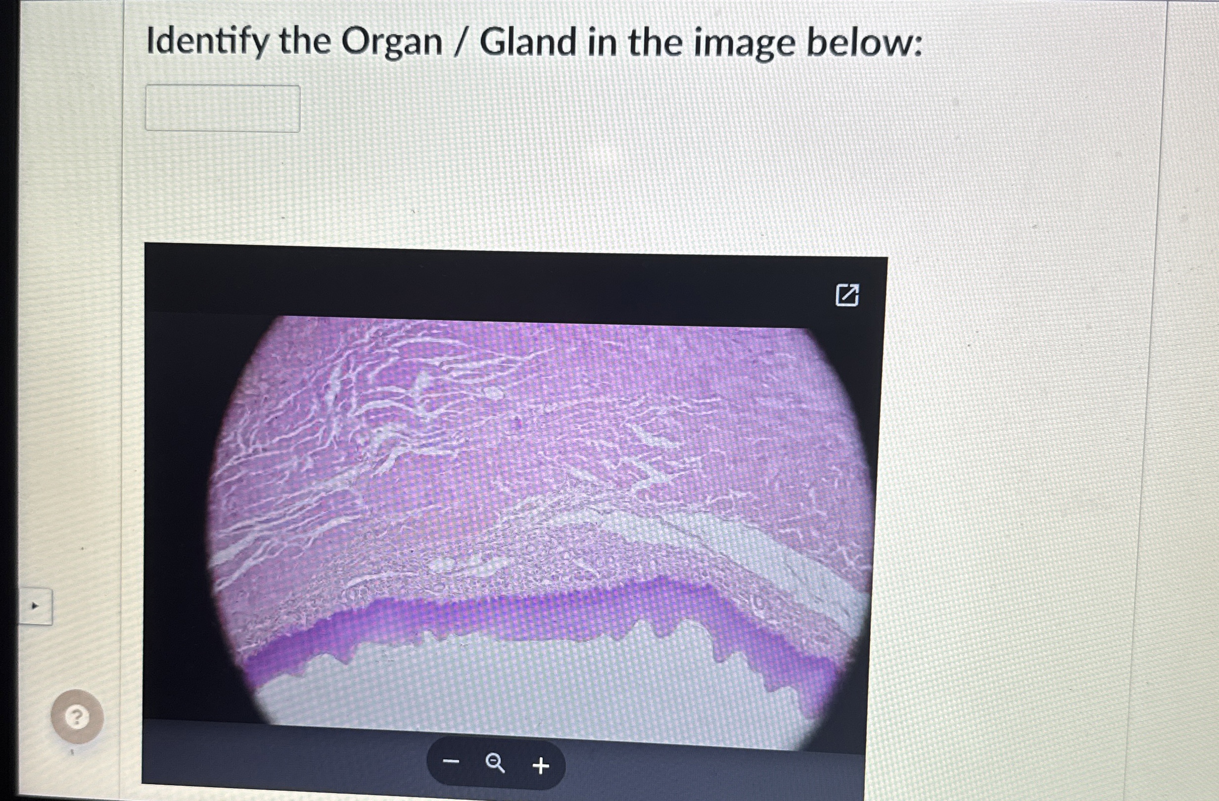 Solved Identify the Organ / ﻿Gland in the image below: | Chegg.com