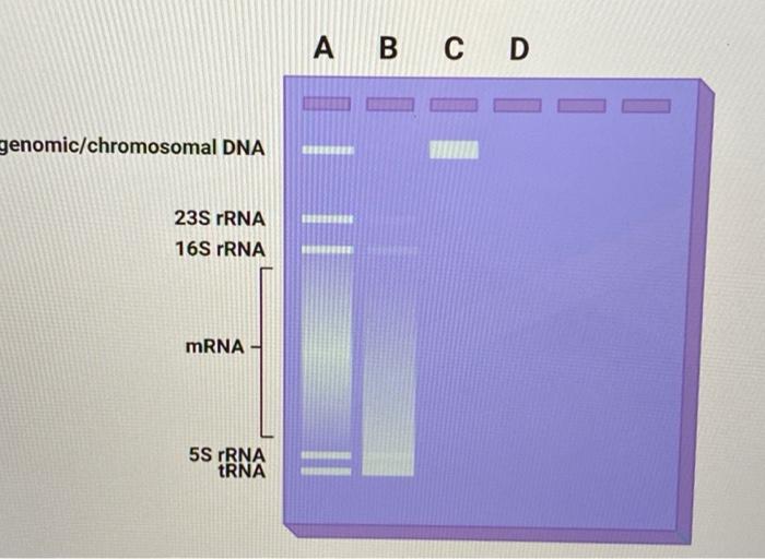 Solved Here is an example gel run by a group of students in | Chegg.com