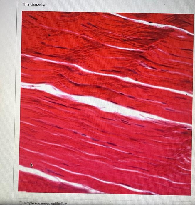 Solved This tissue is: simple squamous epithelium dense | Chegg.com