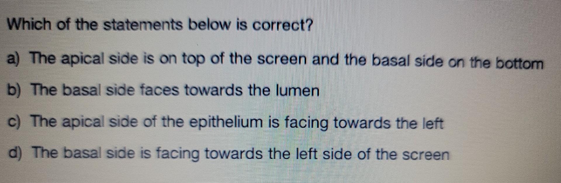 Solved Which of the statements below is correct? a) The | Chegg.com
