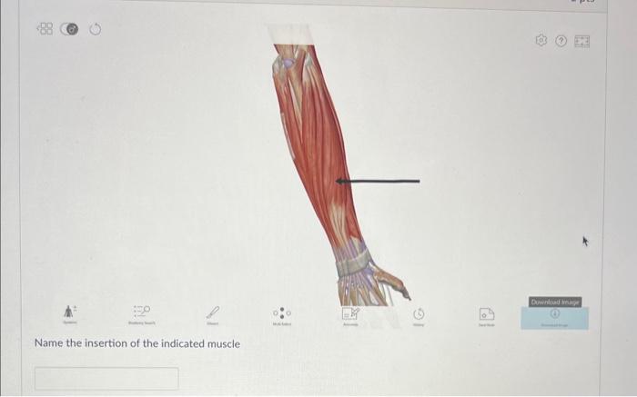 Solved Name one muscle that originates on the transverse | Chegg.com