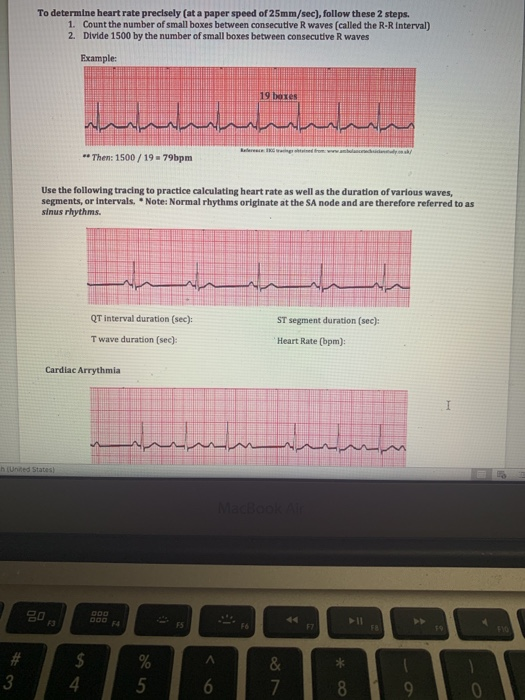 Solved To determine heart rate precisely (at a paper speed | Chegg.com