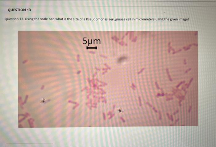 Solved Question 12. Using the scale bar, what is the size of | Chegg.com