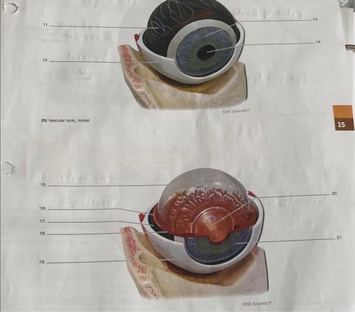 (b) Vascular tunic, modal | Chegg.com