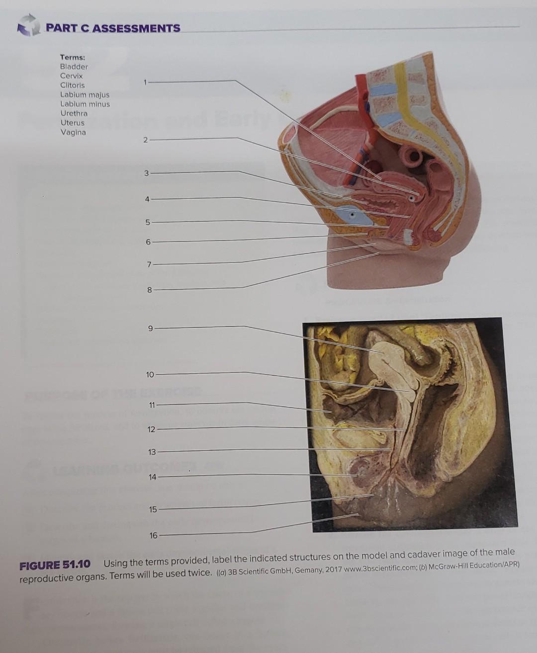 Solved PART C ASSESSMENTS Terms: Bladder Cervix Clitoris | Chegg.com