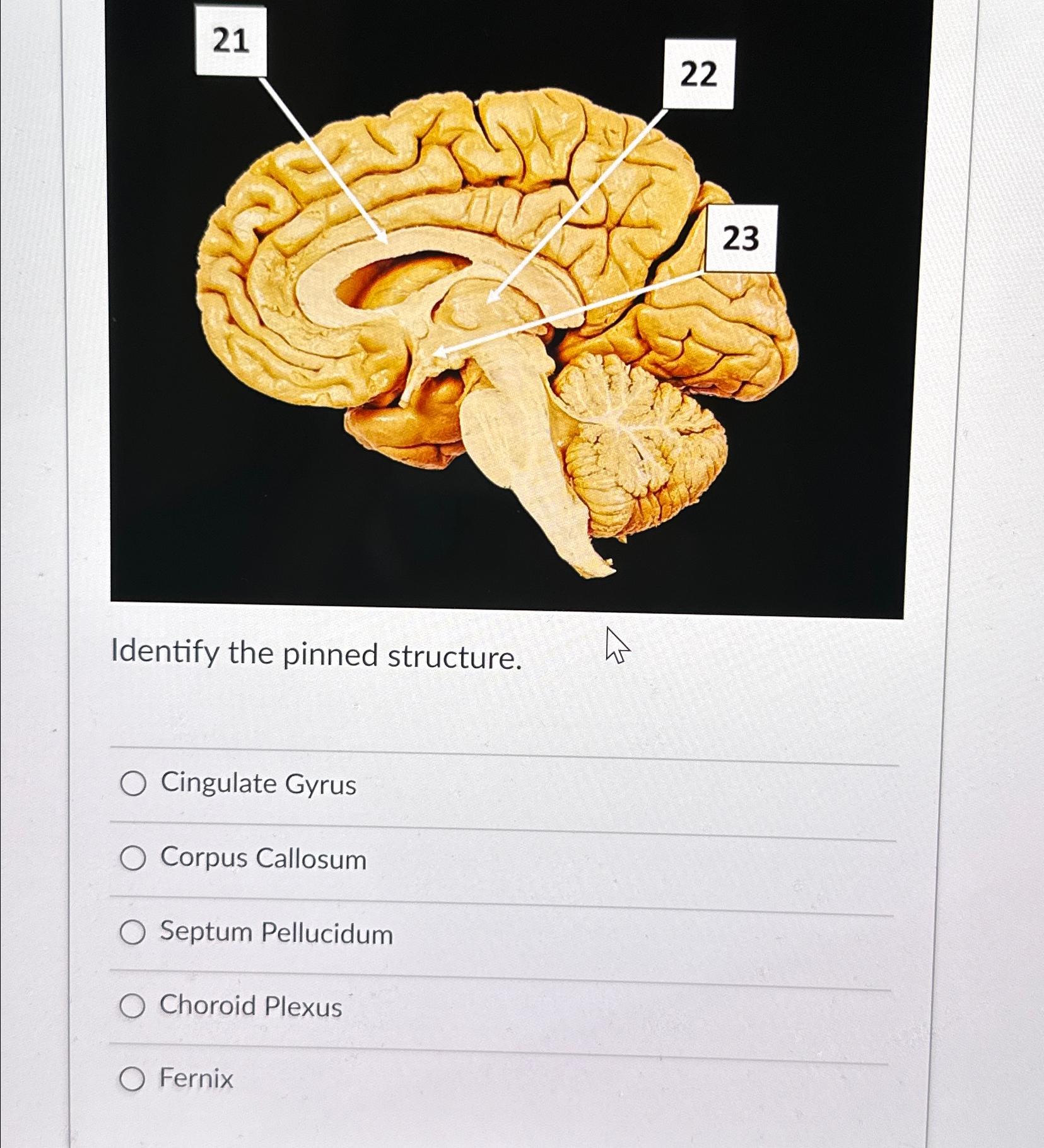 Solved Identify the pinned structure.Cingulate GyrusCorpus | Chegg.com