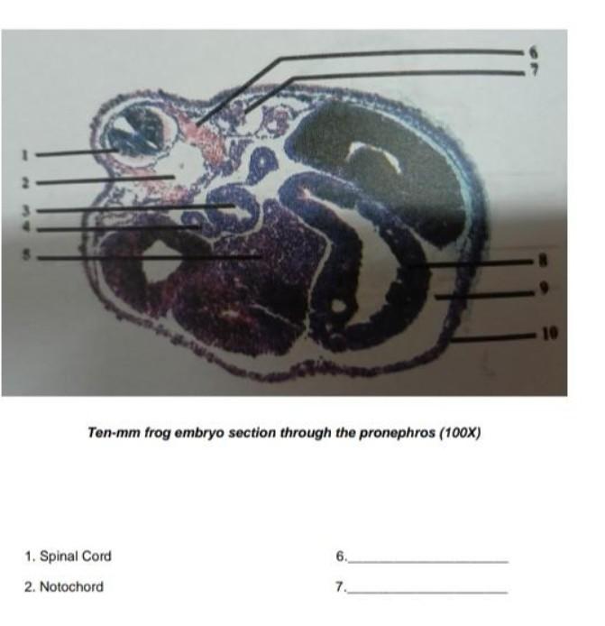 Solved 3. Label the structures of the late embryonic | Chegg.com