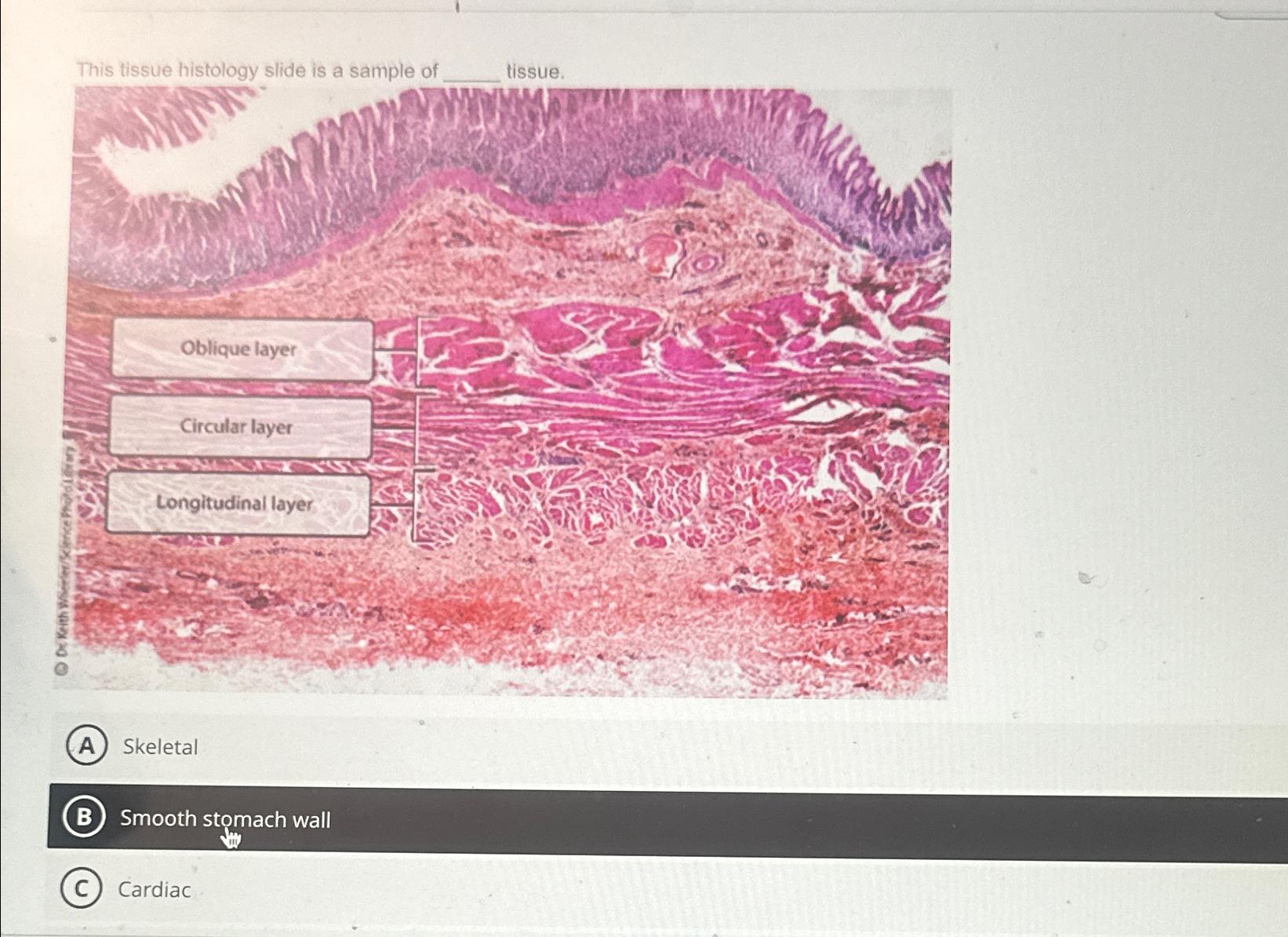 Solved This tissue histology slide is a sample of tissue.(A) | Chegg.com