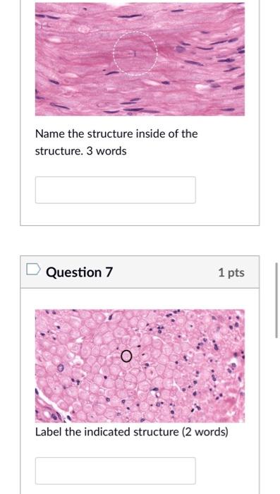 Solved Name the structure inside of the structure. 3 words | Chegg.com