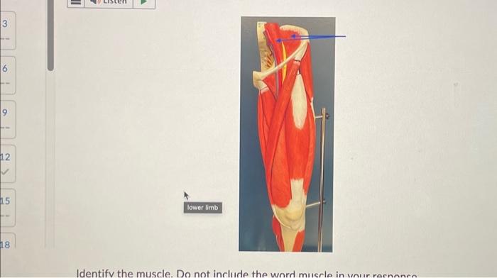 Solved Identify the muscle. Do not include the word muscle | Chegg.com