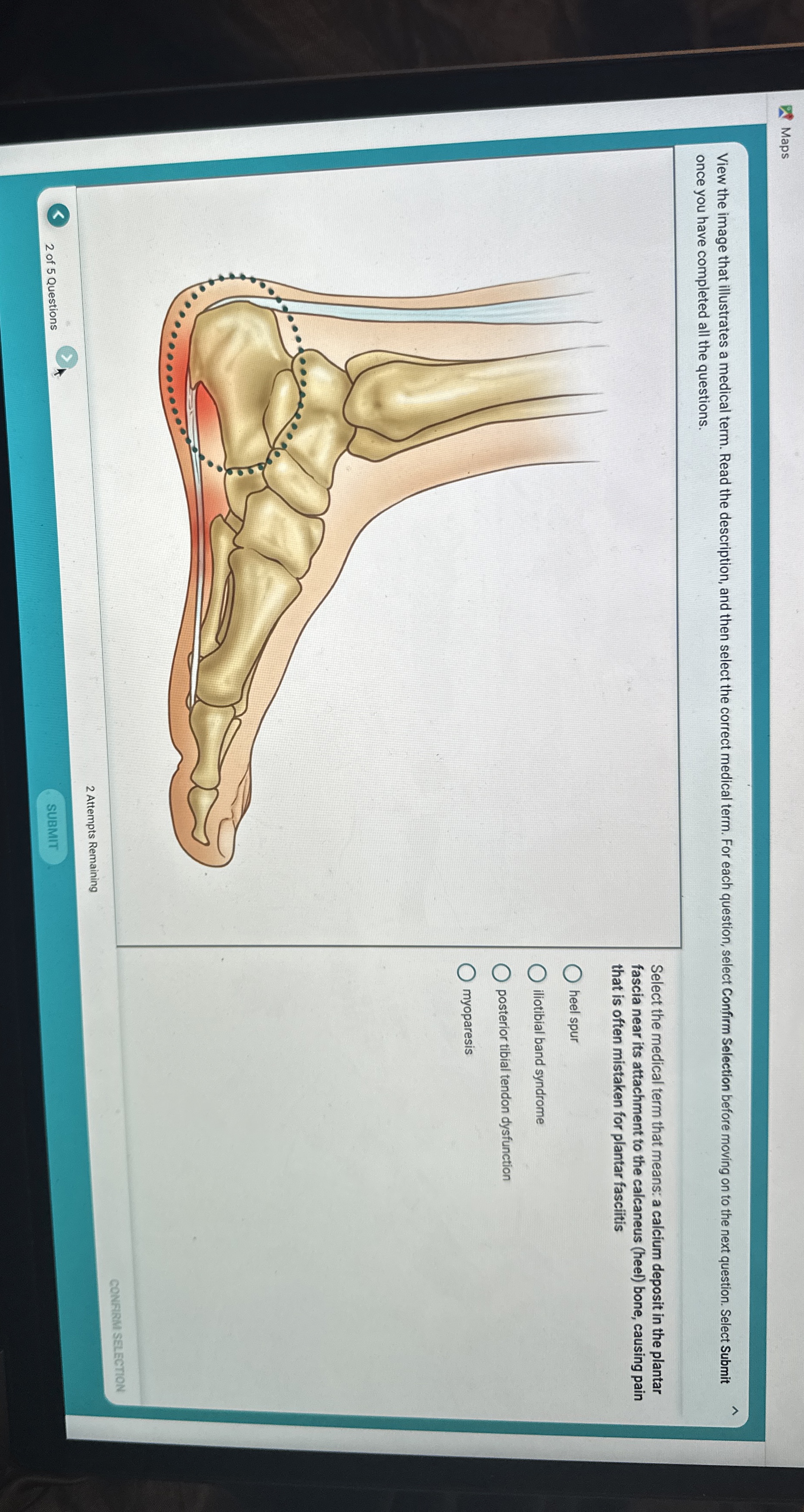 Solved MapsView the image that illustrates a medical term. | Chegg.com