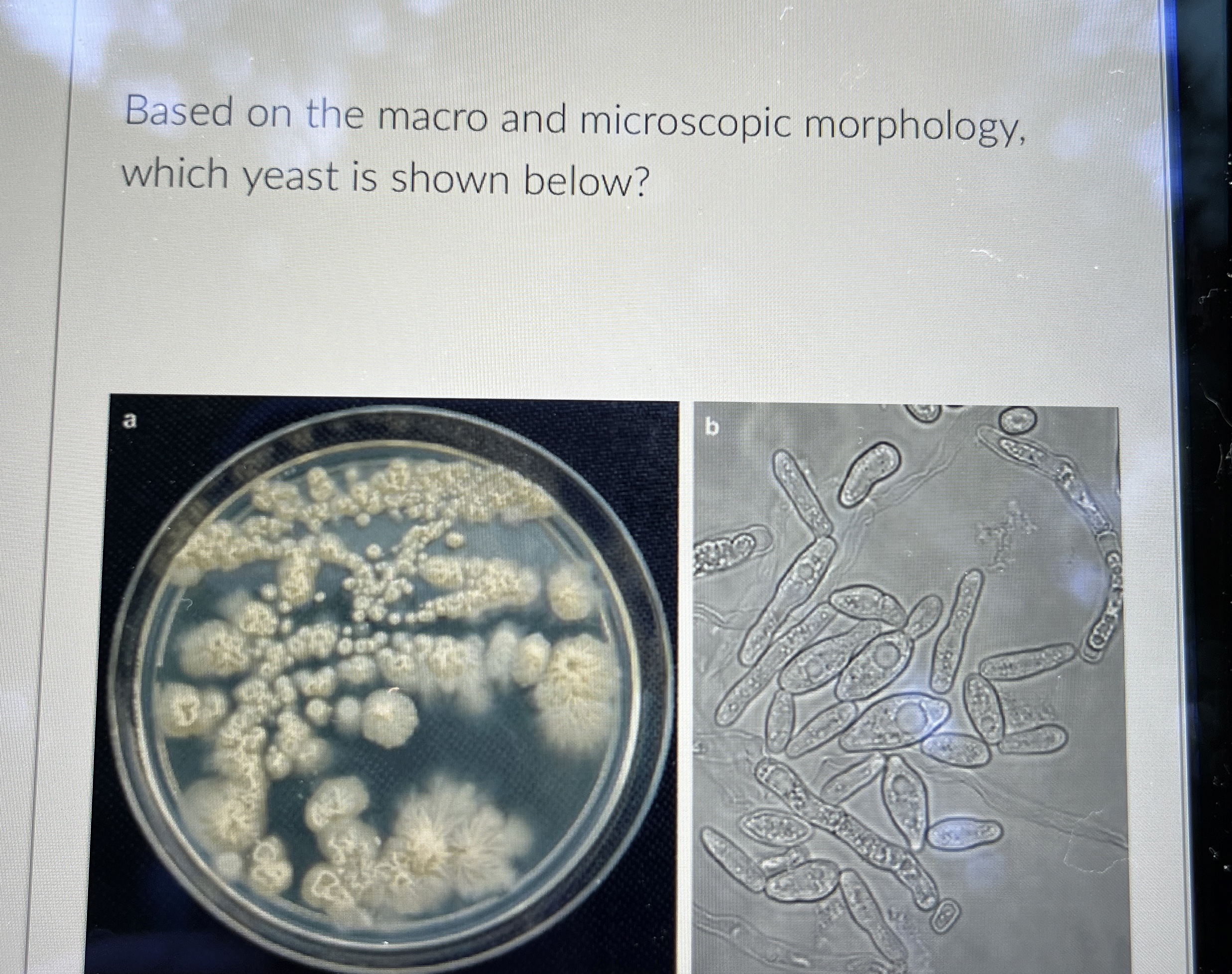 Solved Based on the macro and microscopic morphology, which | Chegg.com
