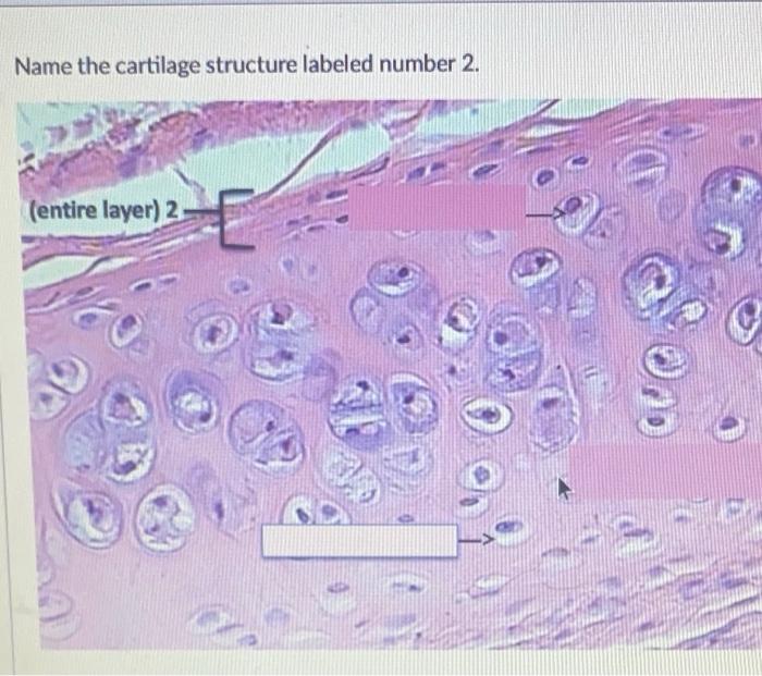 Solved Name the cartilage structure labeled number 2. | Chegg.com