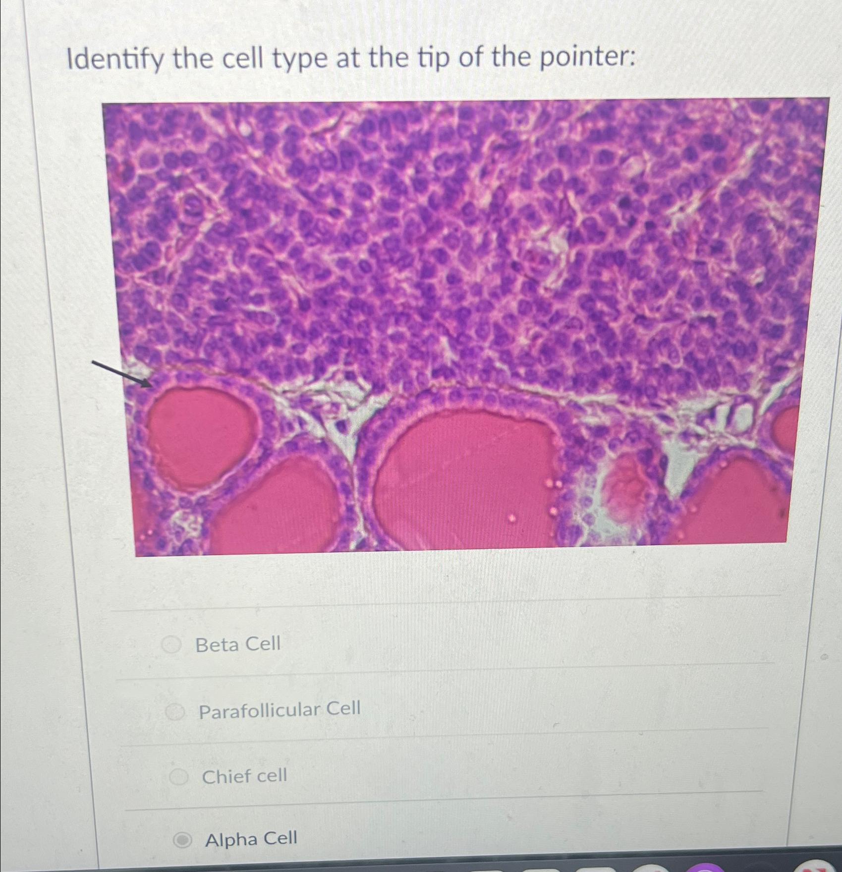 Solved Identify the cell type at the tip of the pointer:Beta | Chegg.com
