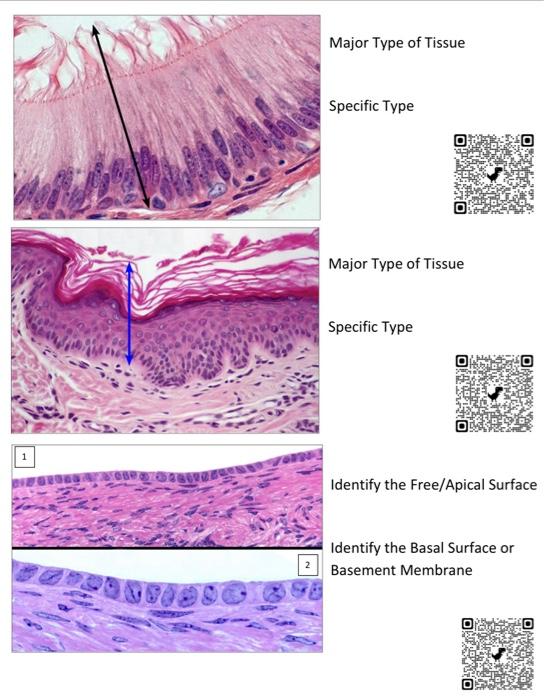 Solved Major Type of Tissue Specific Type Major Type of | Chegg.com
