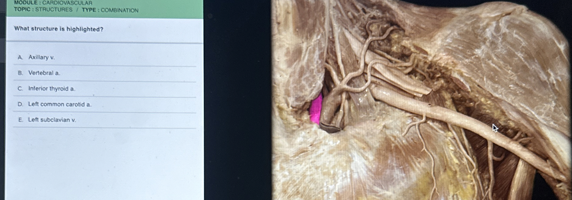 MODULE: CARDIOVASCULARTOPIC : STRUCTURES / ﻿TYPE : | Chegg.com