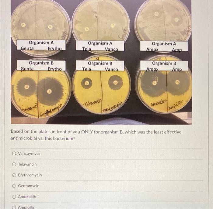 Solved Organism A Genta Erytho Organism A Tela Vanco | Chegg.com