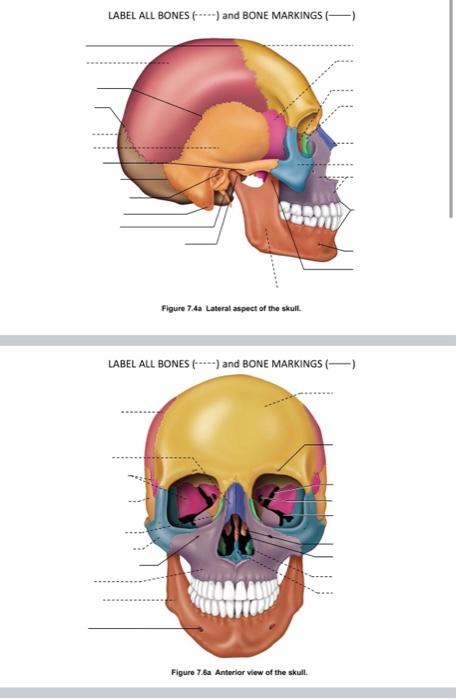Solved LABEL ALL BONES (⋯⋯) and BONE MARKINGS (−) Figure | Chegg.com