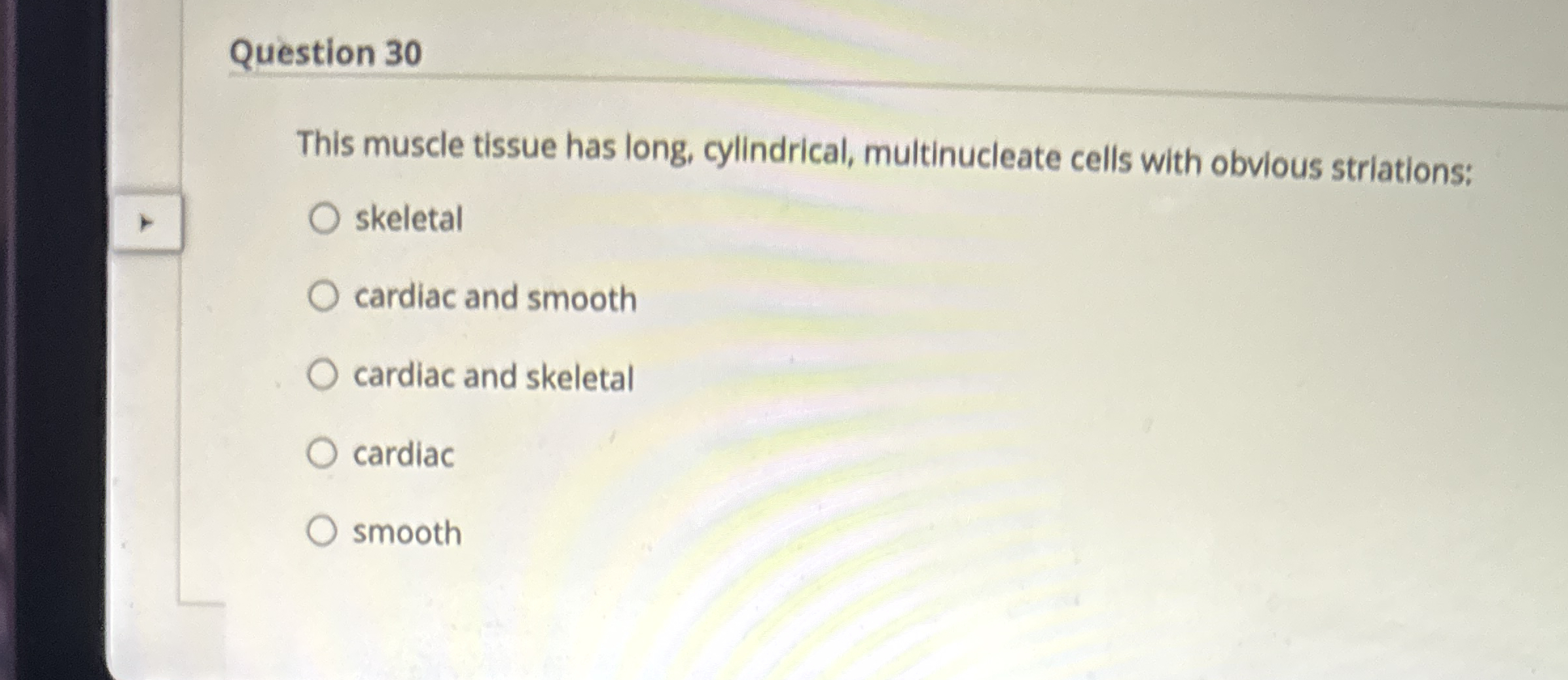 Solved Question 30This muscle tissue has long, cylindrical, | Chegg.com