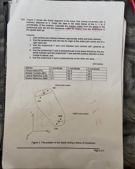 Solved Q2) Figure 2 shows the shank segment of the lower | Chegg.com
