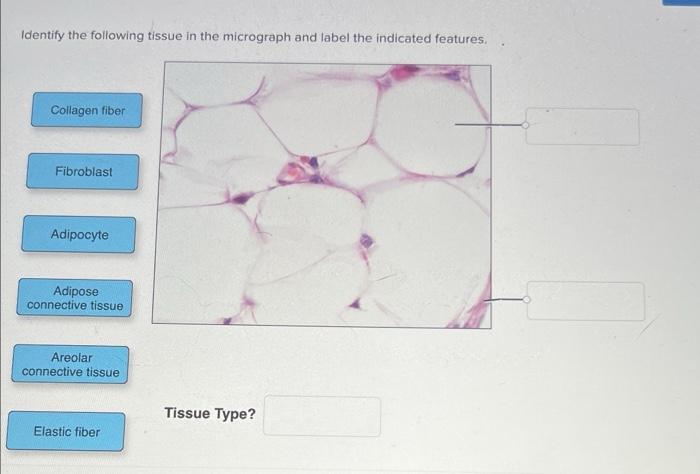Identify the following tissue in the micrograph and | Chegg.com