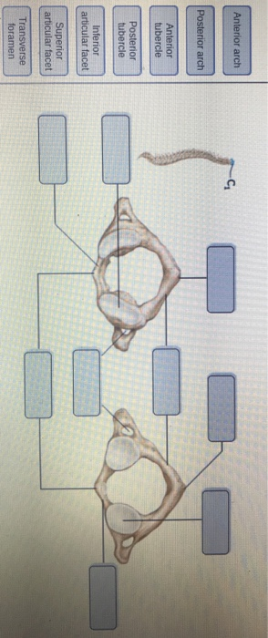 Solved Anterior arch Posterior arch Anterior tubercle | Chegg.com