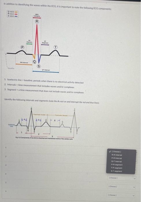 Solved In addition to idcnityine the waves within the ECG, | Chegg.com