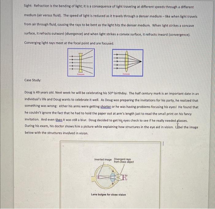 Solved 1. During accommodation for close vision, do the | Chegg.com