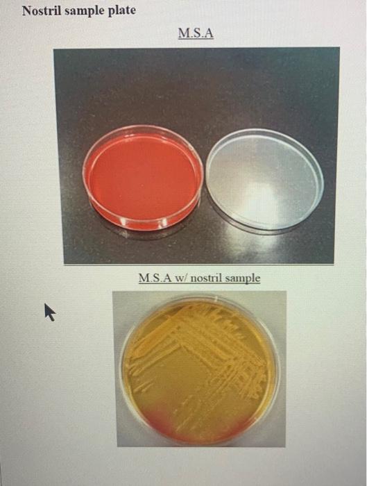 Solved Nostril Sample MSA PLATE Are isolated colonies larger | Chegg.com