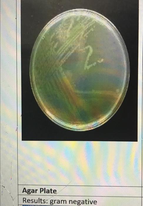 Solved Agar Plate Results: gram negative | Chegg.com
