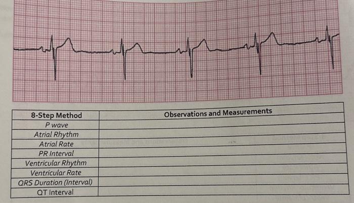 Solved ekg reading using 8 step method of (x 0.04 )please | Chegg.com