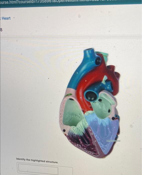 Solved What structure is highlighted? A Do these vessels | Chegg.com