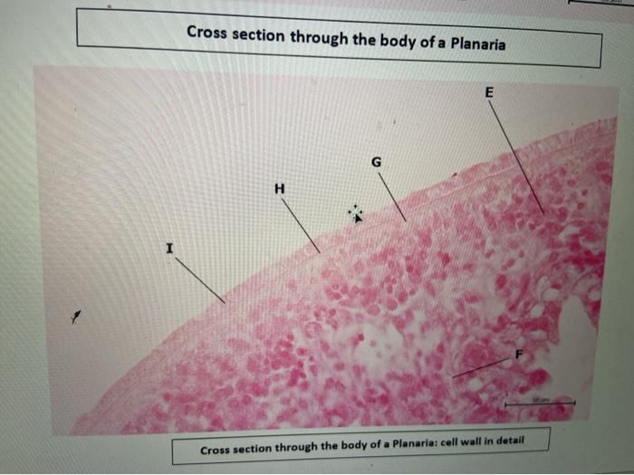 Solved 2E. Describe the sequence of tissues in the inset, | Chegg.com