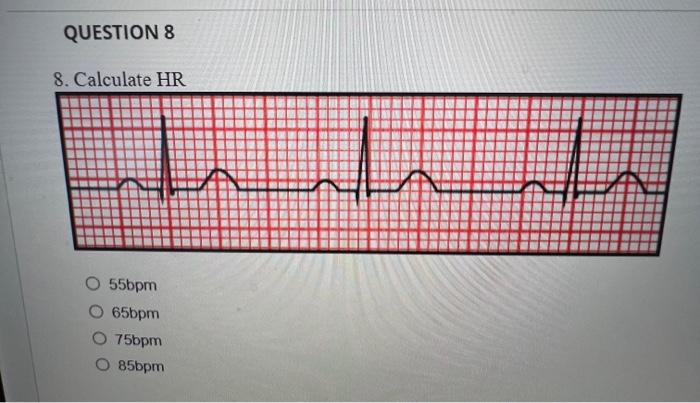 Solved QUESTION 8 55bpm 65bpm 75bpm 85bpm | Chegg.com