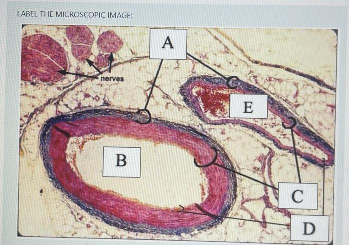 Solved LABEL THE MICROSCOPIC IMAGE: A nerves E B C D LABEL | Chegg.com
