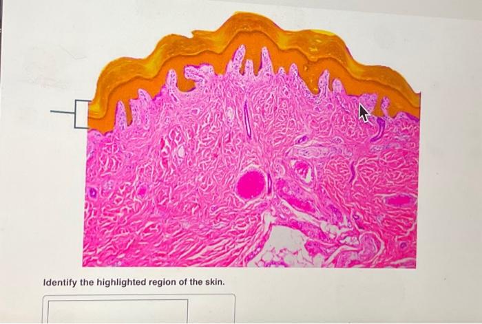 Solved Identify the highlighted region of the skin. | Chegg.com