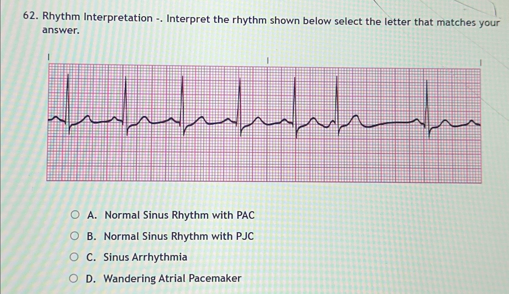 Solved Rhythm Interpretation -. ﻿Interpret the rhythm shown | Chegg.com