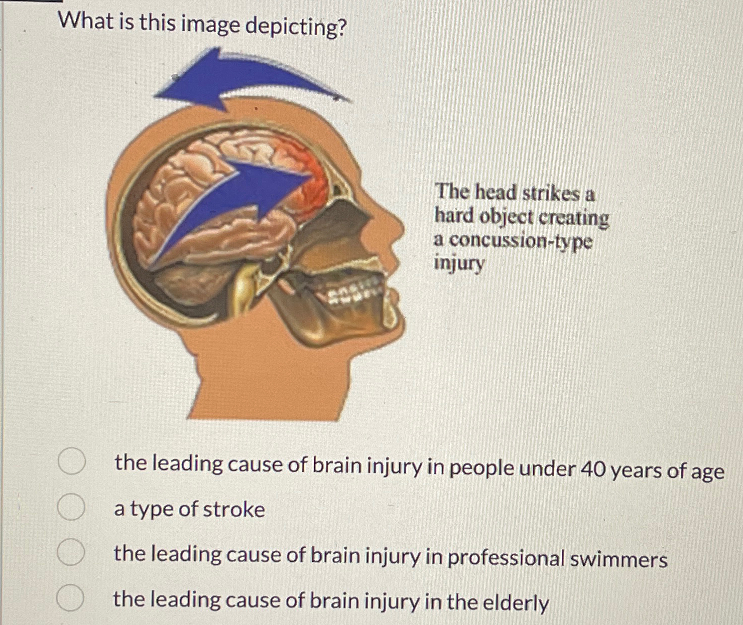 Solved What is this image depicting?The head strikes a hard | Chegg.com