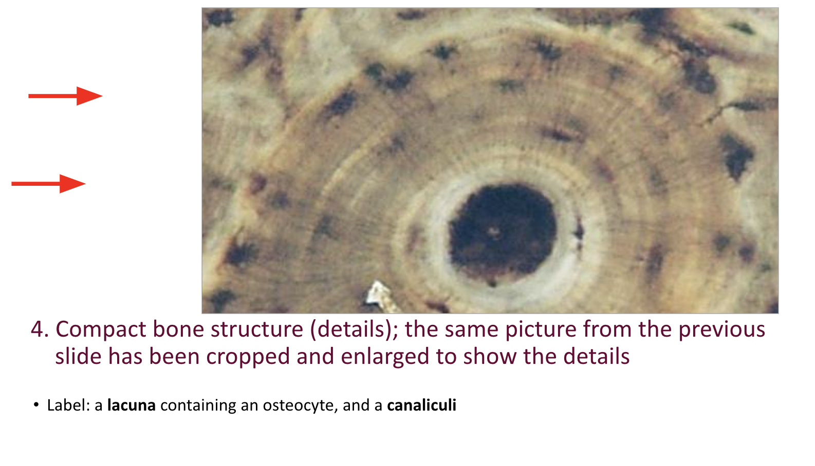 Solved 4. ﻿Compact bone structure (details); the same | Chegg.com