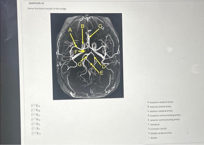 Solved QUESTION 10 Name the blood vessels in this image 10 9 | Chegg.com