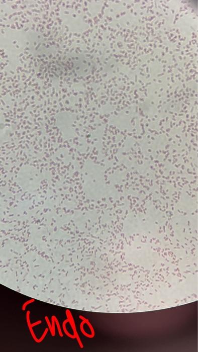 Solved Is this a positive endospore or a negative endospore | Chegg.com
