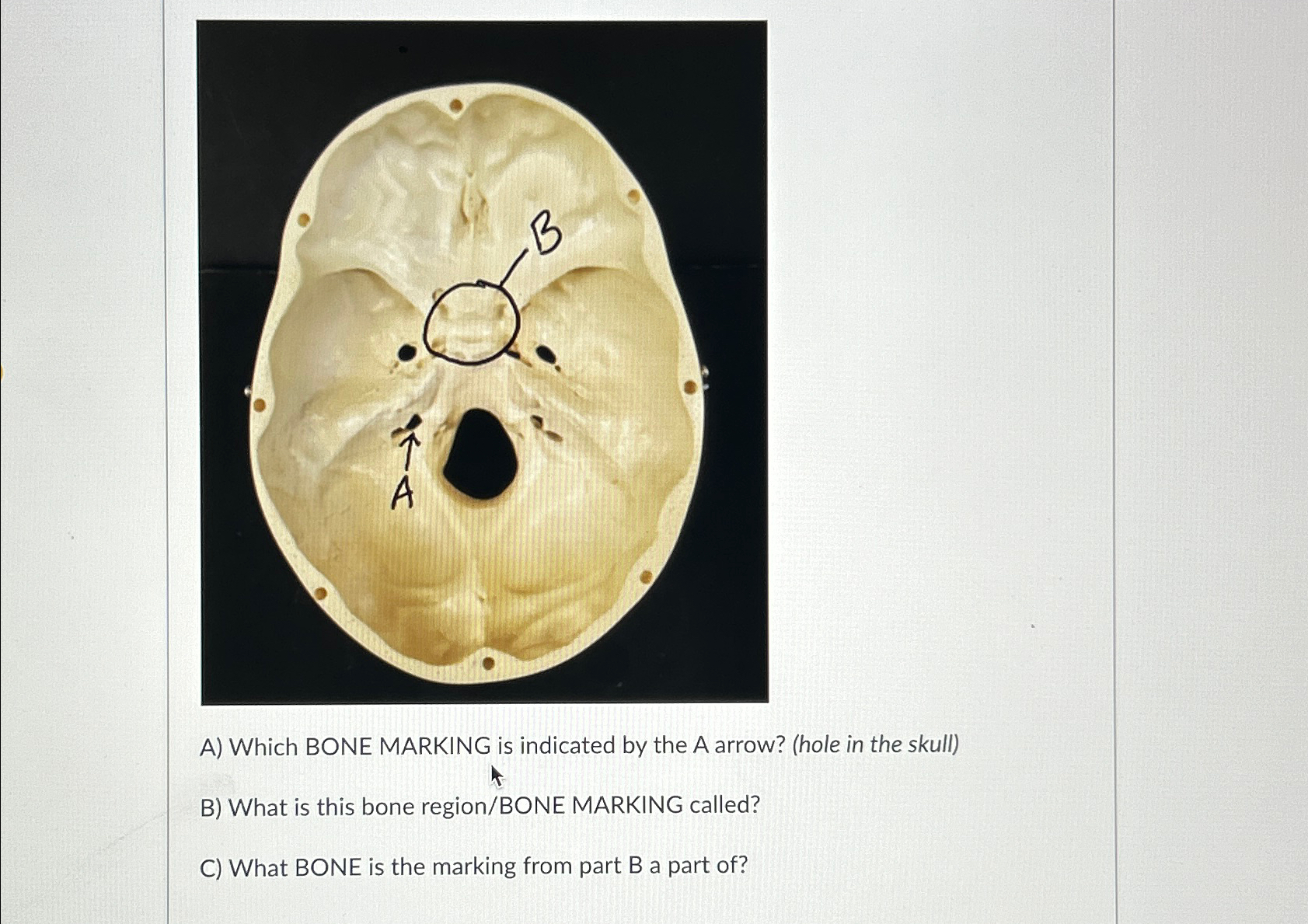 Solved A) ﻿Which BONE MARKING is indicated by the A arrow? | Chegg.com
