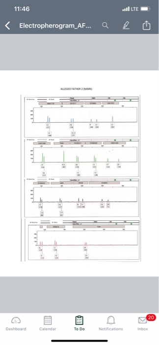 1. Use the electropherograms provided to complete the | Chegg.com