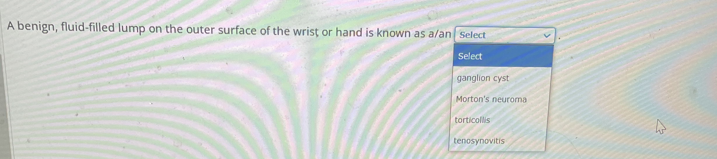 [Solved]: A benign, fluid-filled lump on the outer surface o