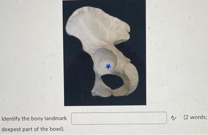 Solved Identify the bony landmark deepest part of the bowl). | Chegg.com